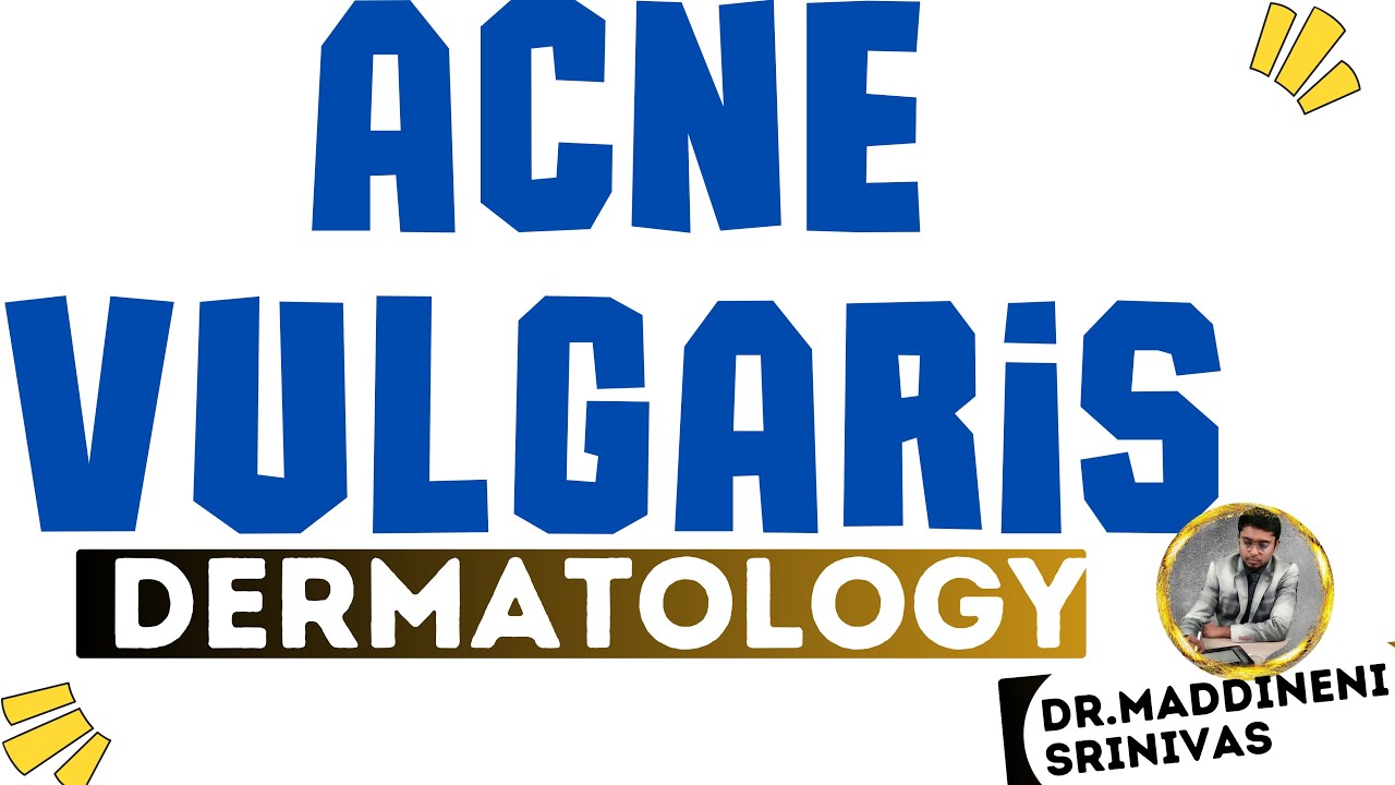 ACNE VULGARIS | Causes Risk factors Clinical features Mx | Dr Maddineni ...