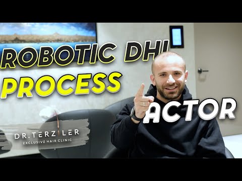 Robotic DHI Process Of Furkan Aksoy Who Is An Actor #furkanaksoy #roboticdhi #drterziler
