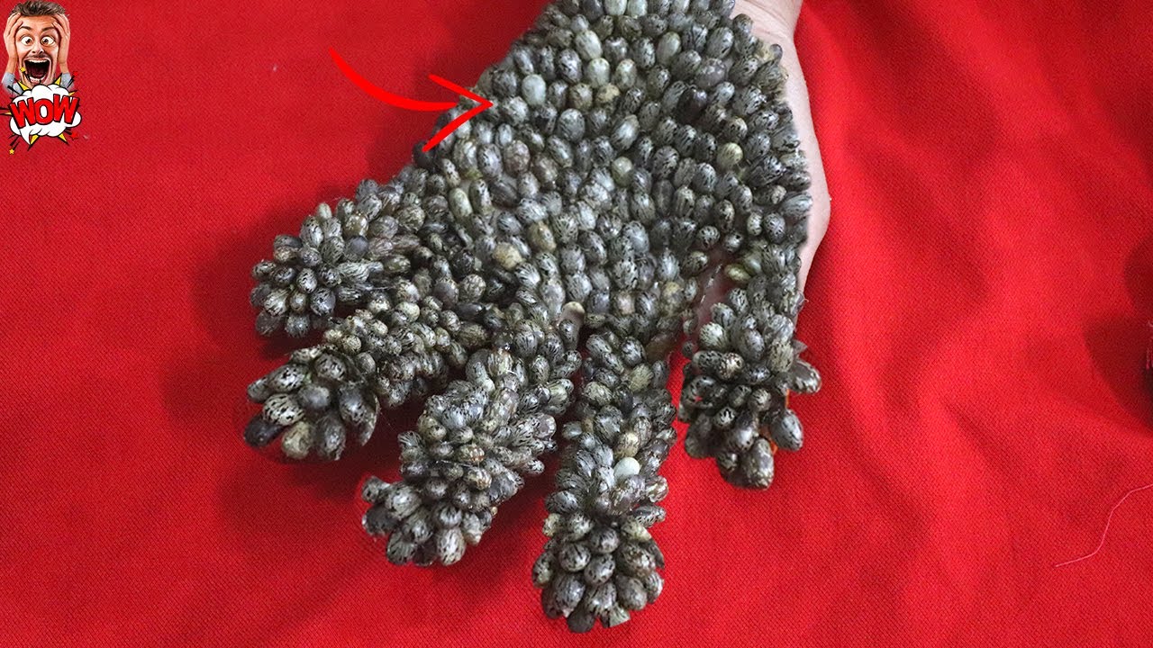 How to Remove Giant Lice on my hand # 147 - YouTube