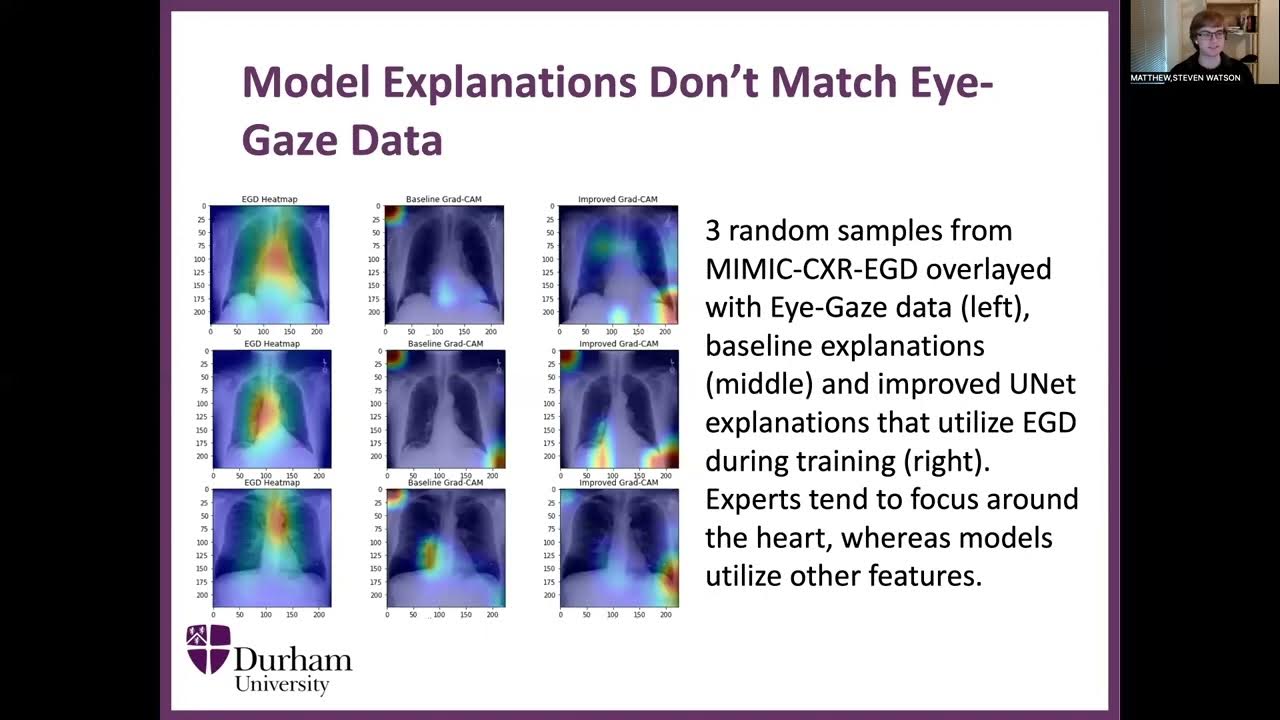 Learning How to MIMIC: Using Model Explanations to Guide Deep Learning Training - YouTube