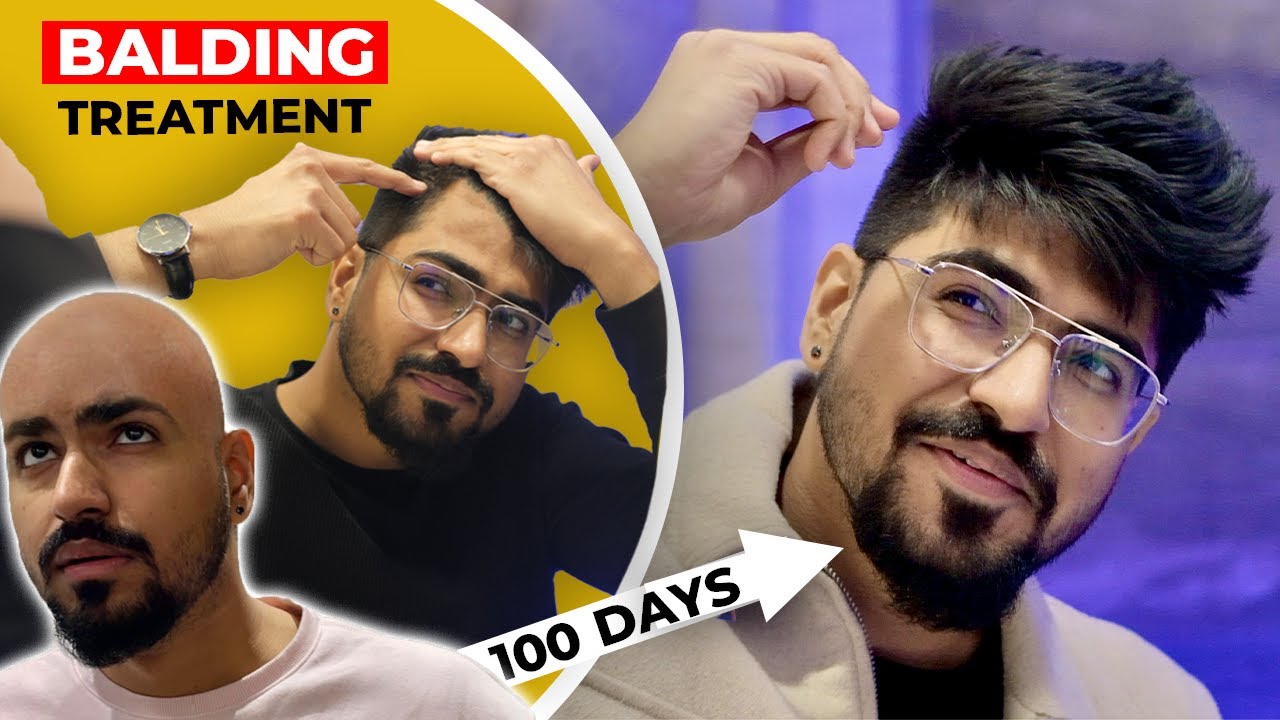 Everything About HAIR LOSS In Men | Jataa For Men Hair Growth Oil | 100 ...