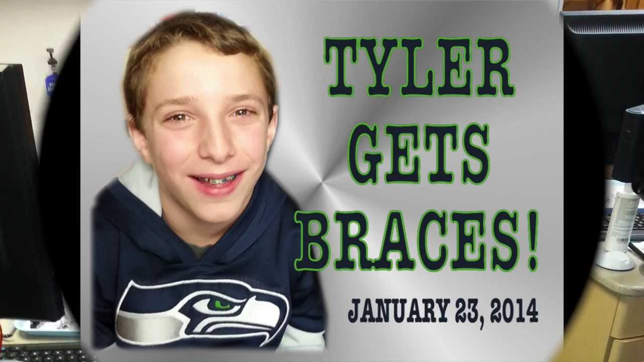 Tyler Gets Braces! - YouTube