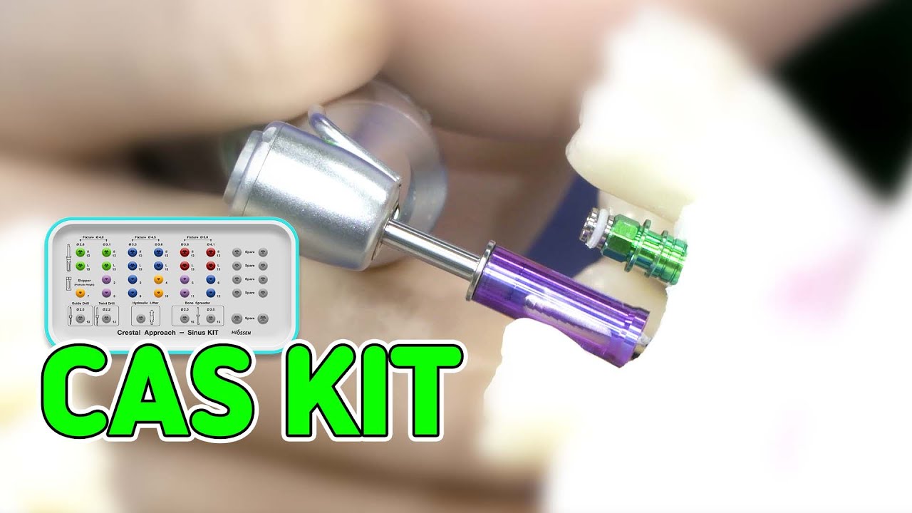 [EASY Hands-on] CAS KIT - #25, #26 Implant installation Case - YouTube
