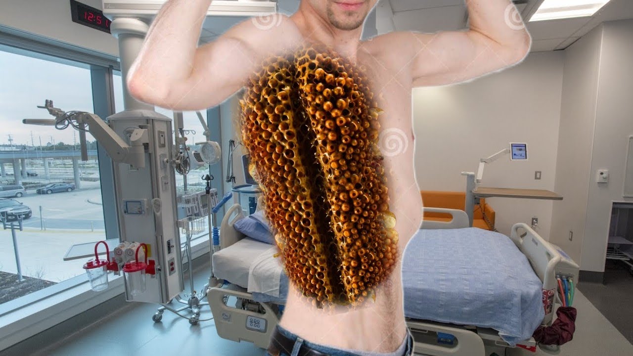 ASMR Animation chest back side treatment | 2nd ASMR treatment Deep ...