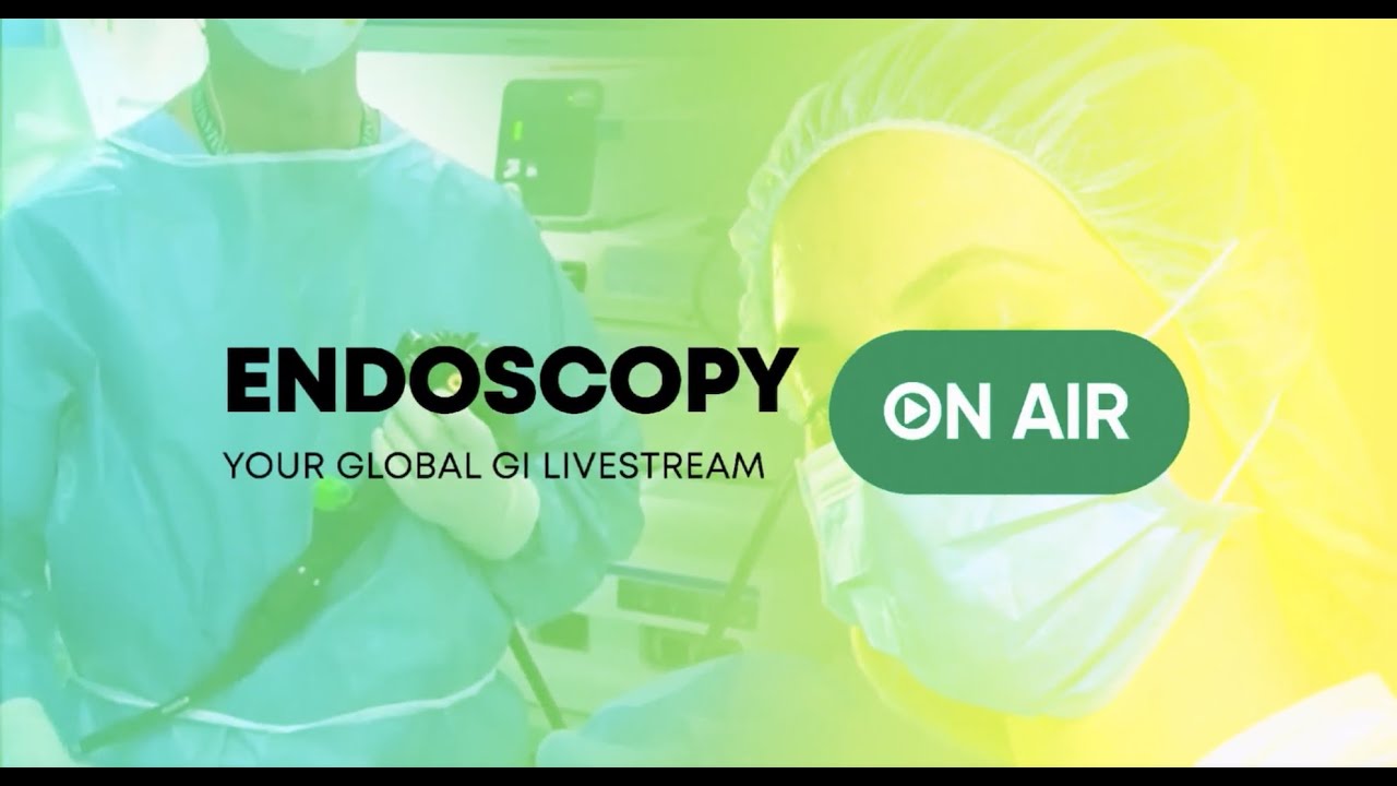 Endoscopy On Air Livestreammeeting Am 5 Juni 2020