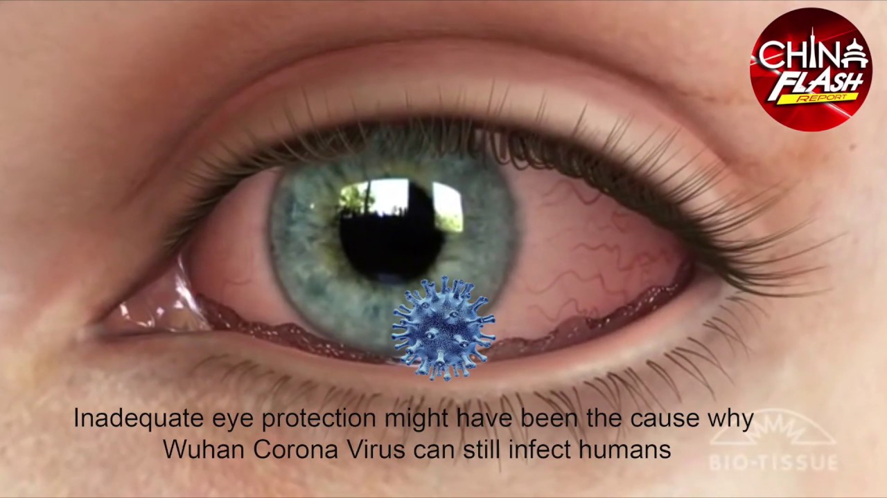 Wuhan Corona Virus can infect humans through the eyes - YouTube