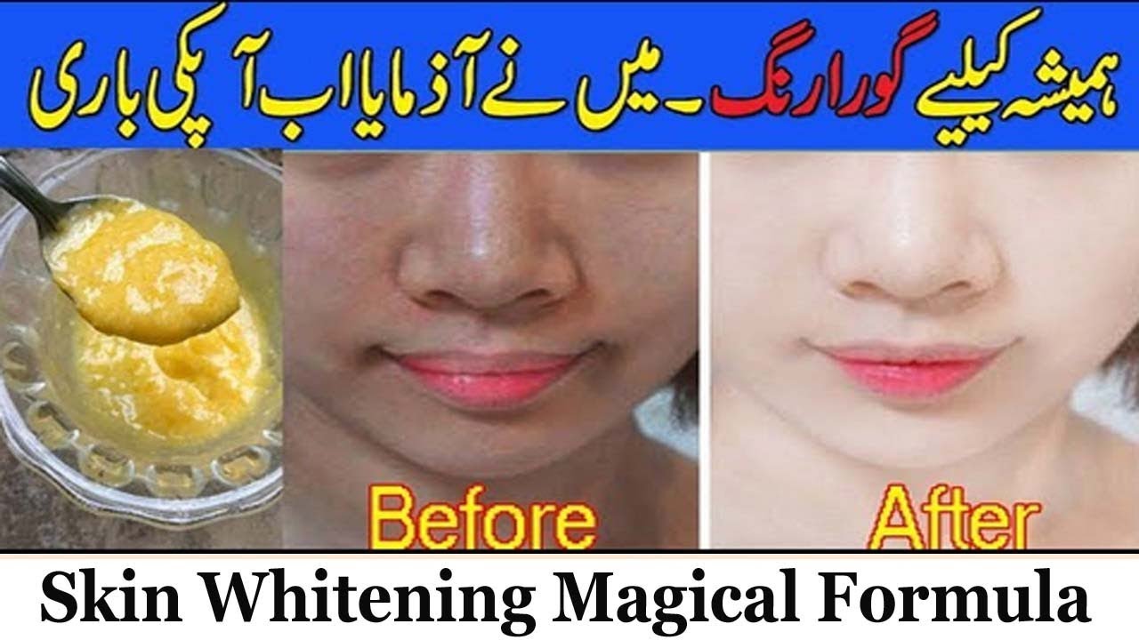 Permanent Skin Whitening Magical Formula For Glowing Skin | Anam Home ...