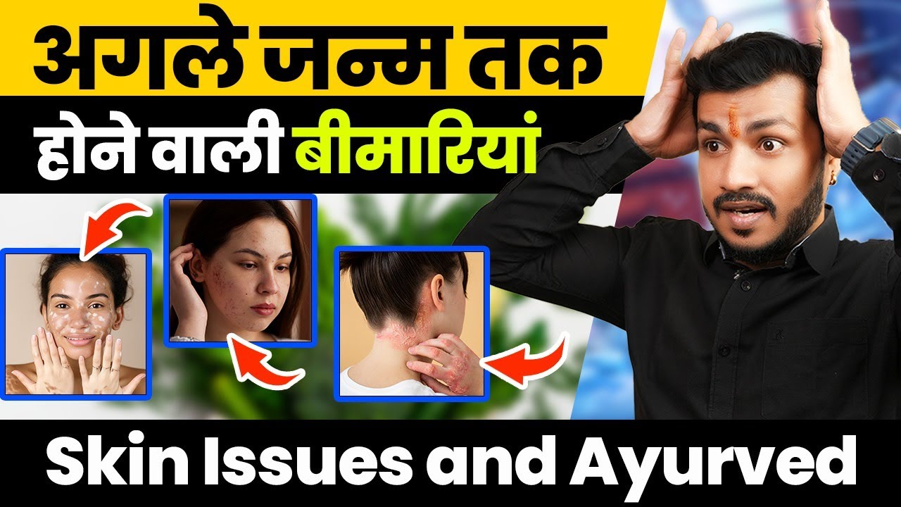 267#Skin Issues and Ayurved|| Kyu Tezi Se Fail Raha Hai Charm Rog ...