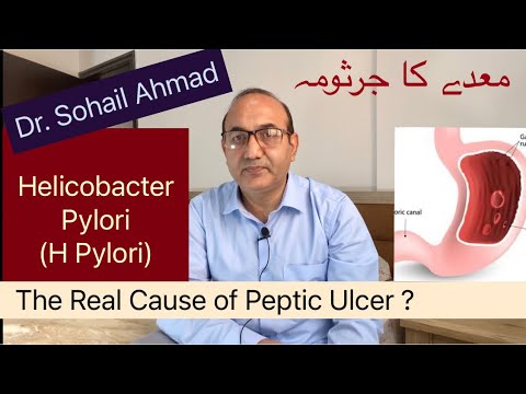 Helicobacter Pylori | The Cause of Peptic Ulcers? Gastric & Duodenal Ulcers | Urdu | Hindi