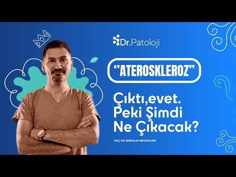 Çıktı Evet Peki Şimdi Ne Çıkacak I Ateroskleroz