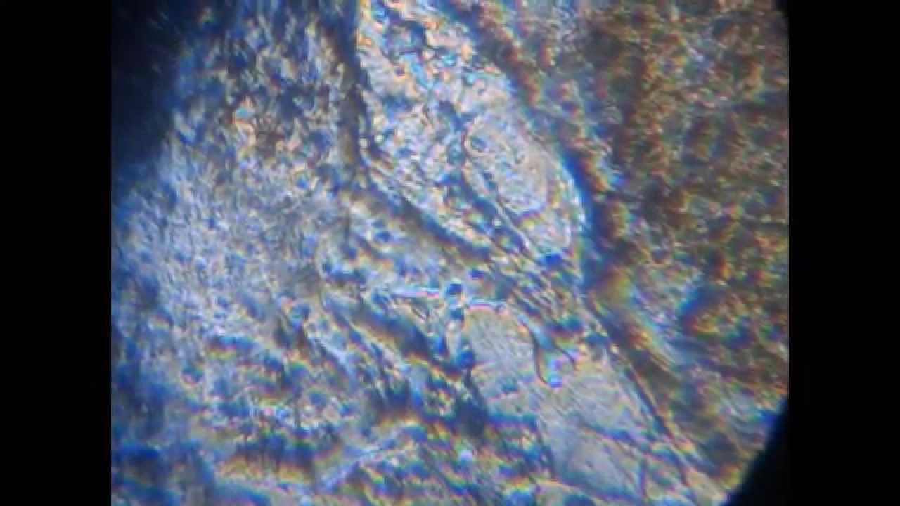 nanotechnology? in my earwax? Creatures killing me.under microscope ...