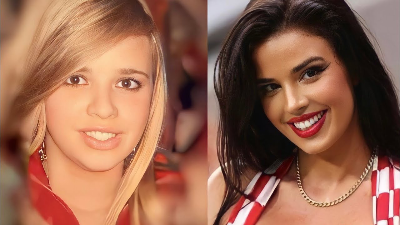 Ivana Knoll PRE i POSLE operacija - YouTube