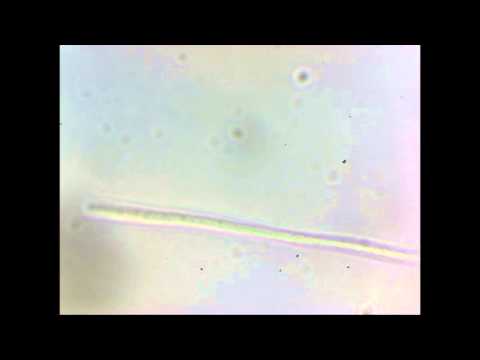 40 Days Of DIY Microbiology Part Four - YouTube
