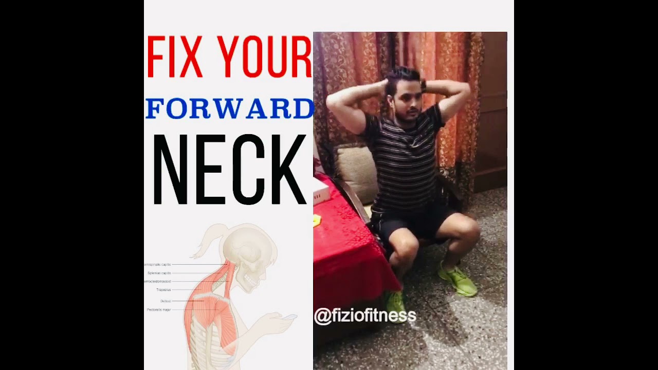 Fix Forward Neck Bending | Rehab Exercises | Cervical spondylosis ...
