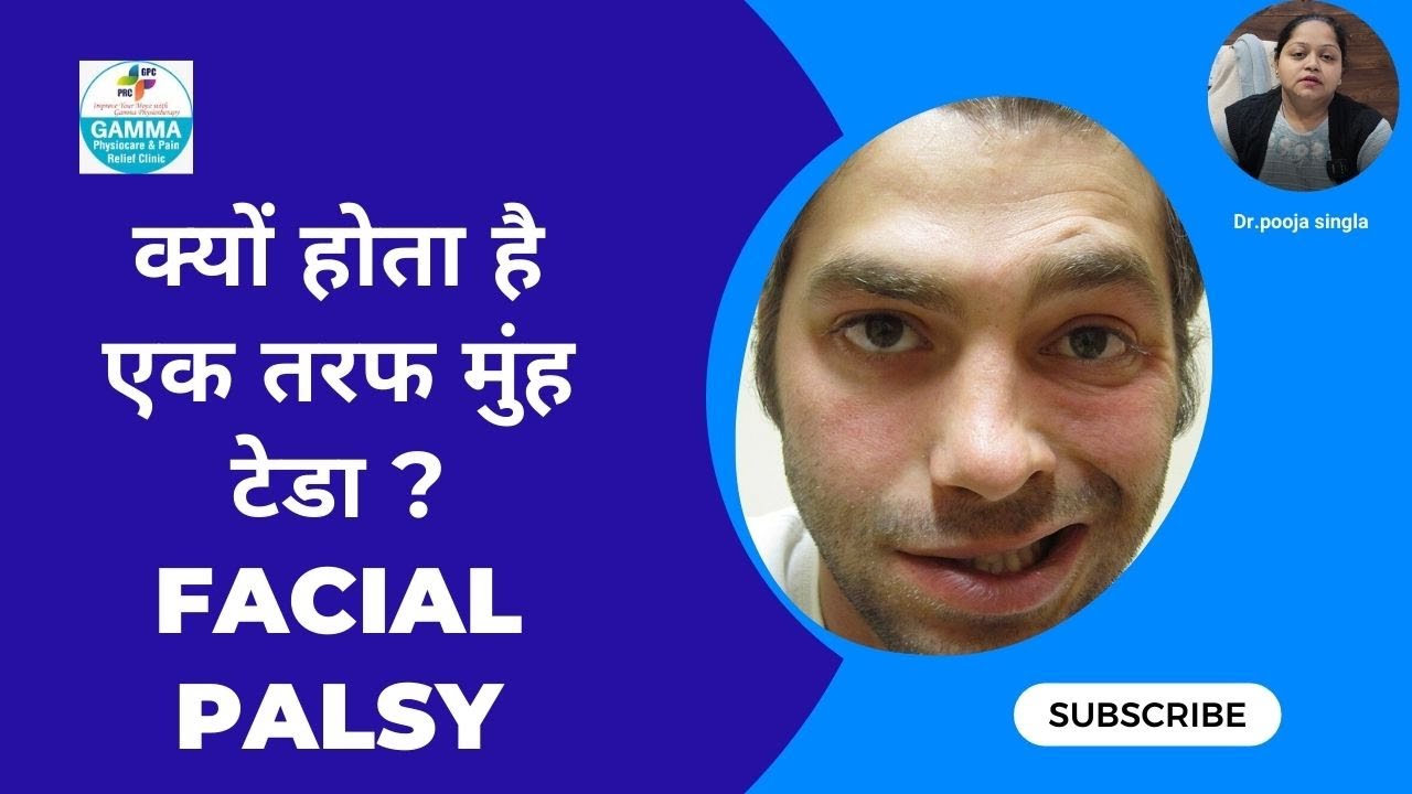 क्यों होता है एक तरफ मुंह टेडा ? ||facial palsy|| Dr.pooja singla ...