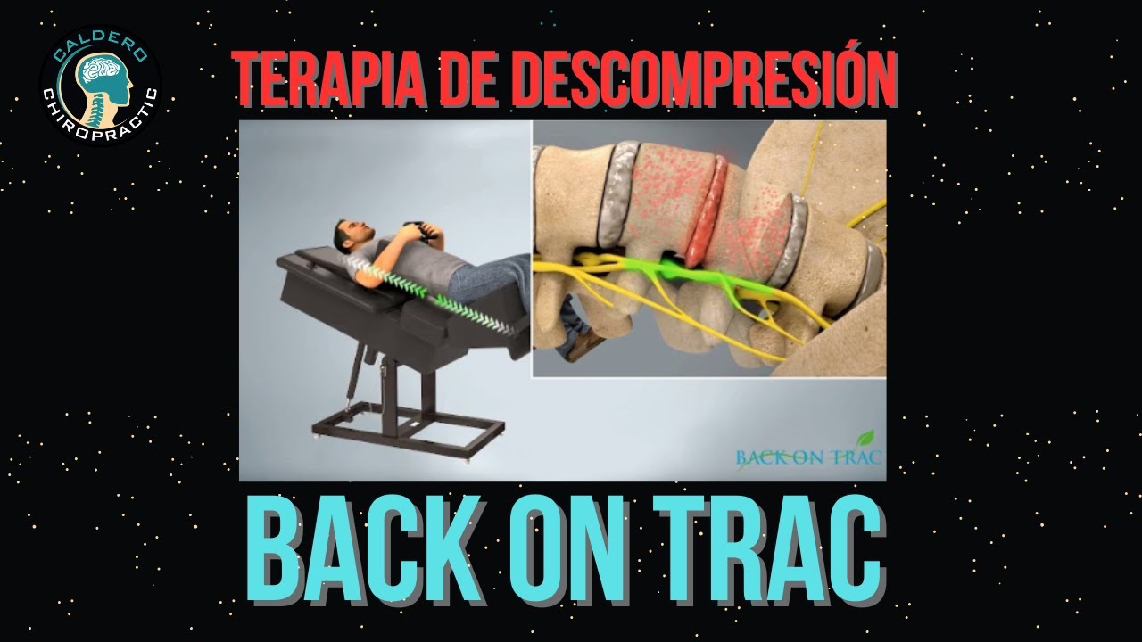Descompresión Espinal con Back on Trac | Alivio del Dolor en Caldero ...