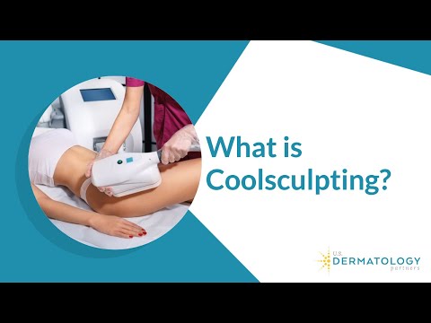 What is Coolsculpting? | Freeze Away Body Fat