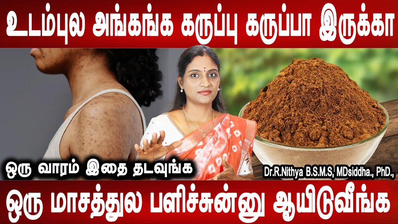 சுகர் இருந்தால் சரும நோய் வரும் | Melasma symptoms , causes & treatment ...