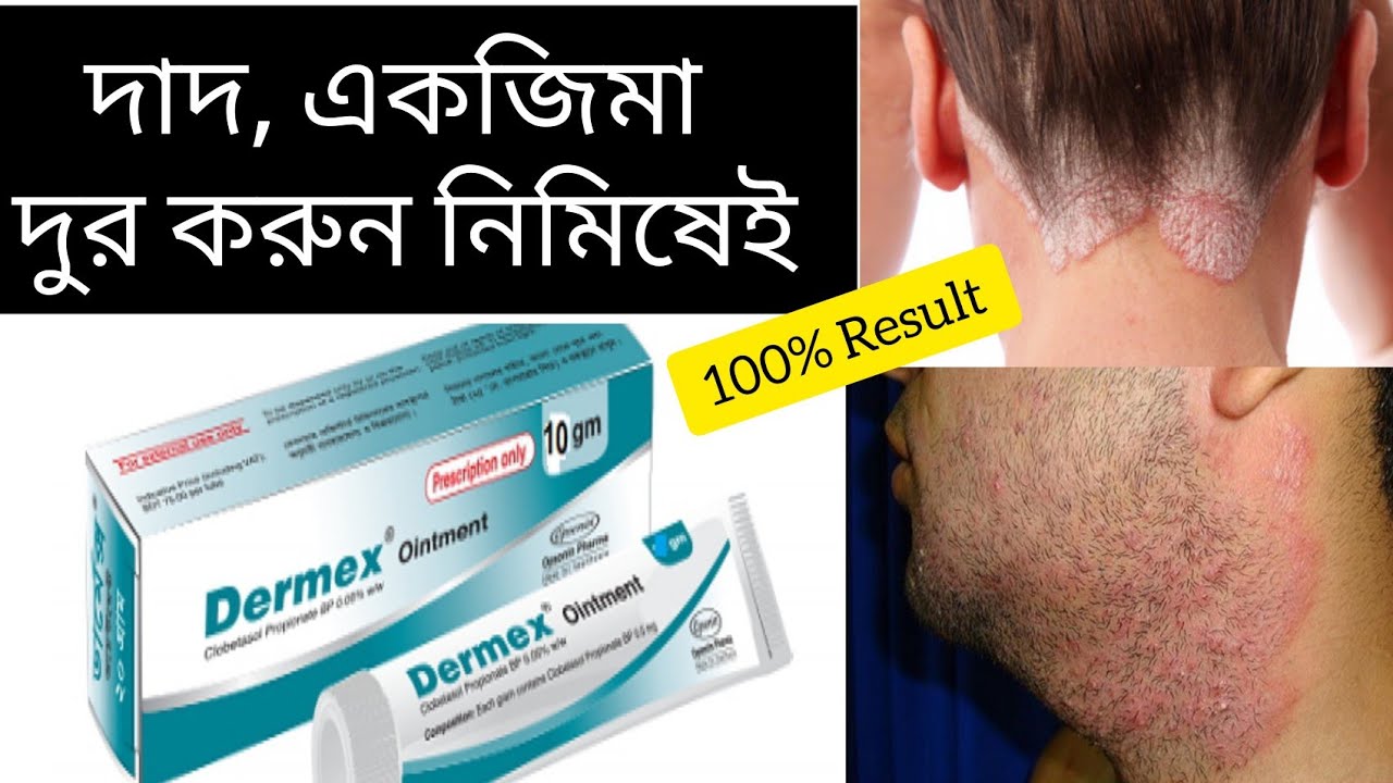 Dermex Ointment। চর্মরোগ ভালো করার মহা ঔষধ? Medicines to cure skin ...