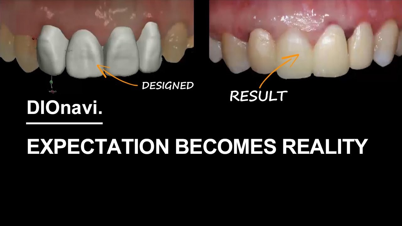 Expectation becomes reality. Introduce process of DIOnavi. - YouTube