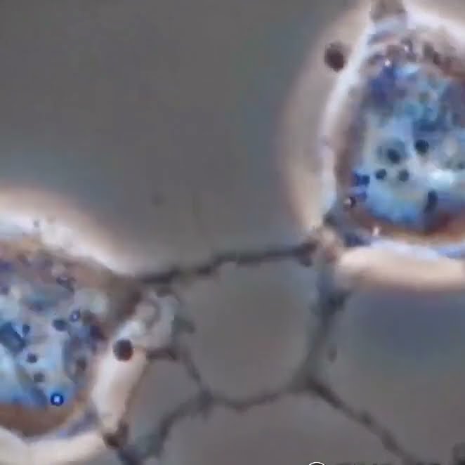 Brain Cells Talking Under The Microscope! 🧠 #science #biology - YouTube