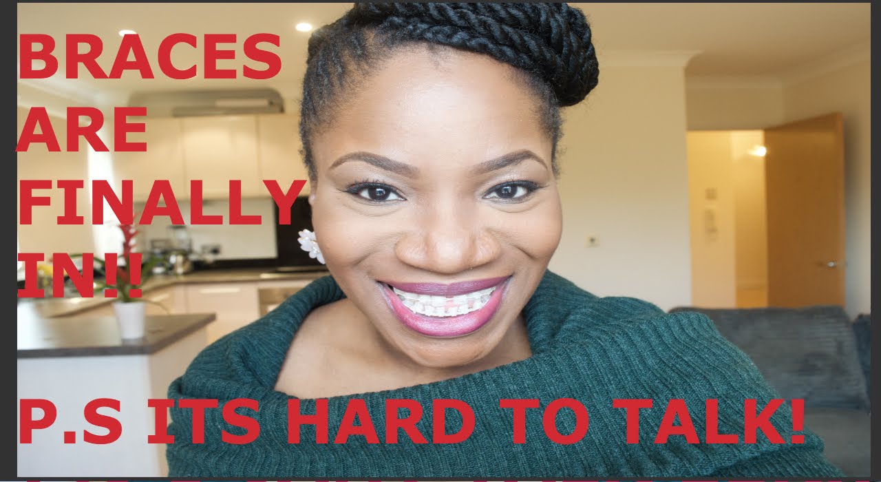#3 - My Braces Journey - One Week Update & Brace Fit Process - YouTube