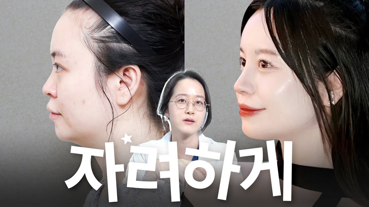 자려한 코 만드는 방법 기린성형외과 Youtube