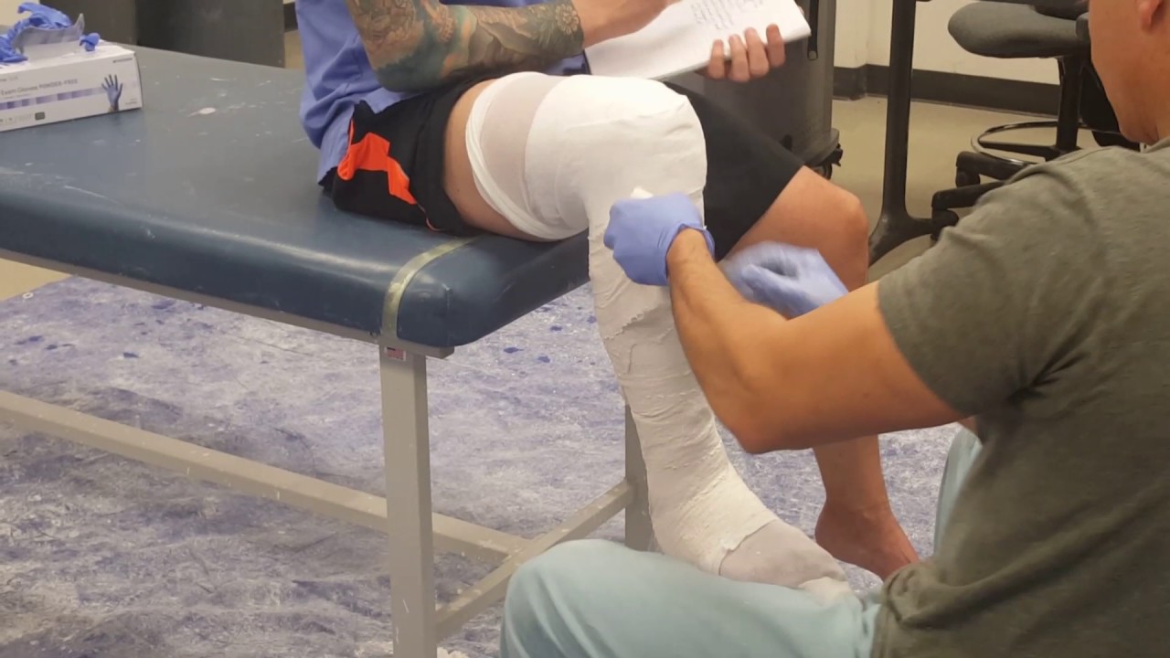 Delbet Cast - YouTube