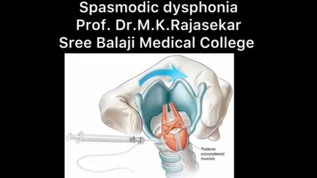Spasmodic Dysphonia - YouTube