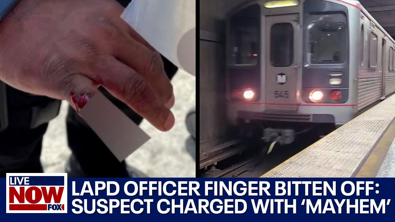 LA officer finger bitten off: Suspect charged with 'mayhem,' held on ...