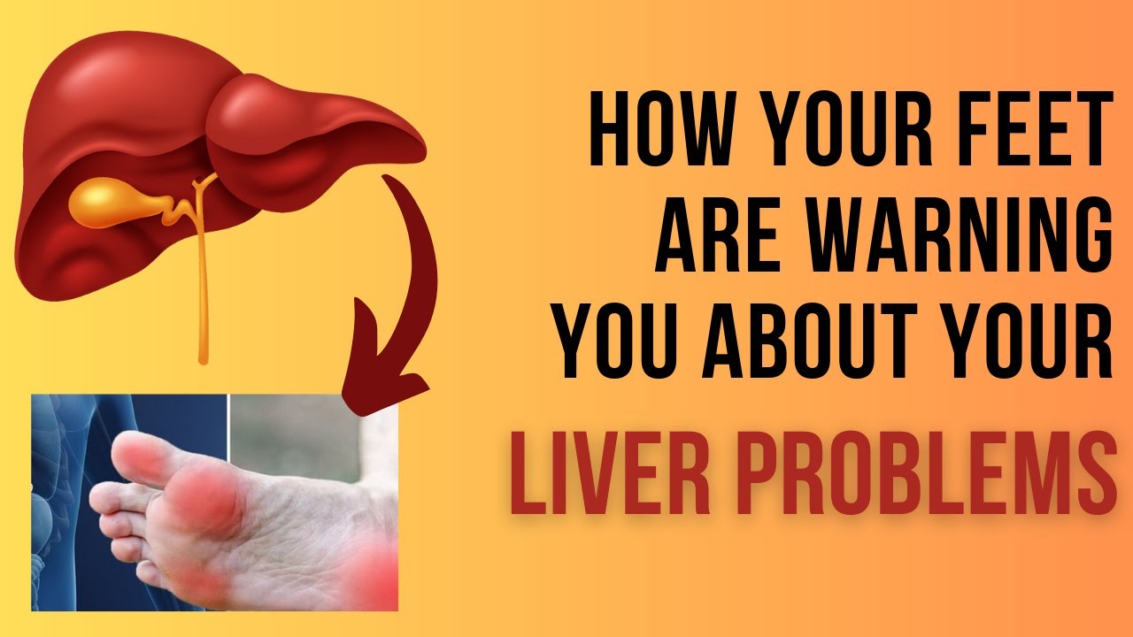 How Your Feet Are Warning You About Your Liver Problems - YouTube