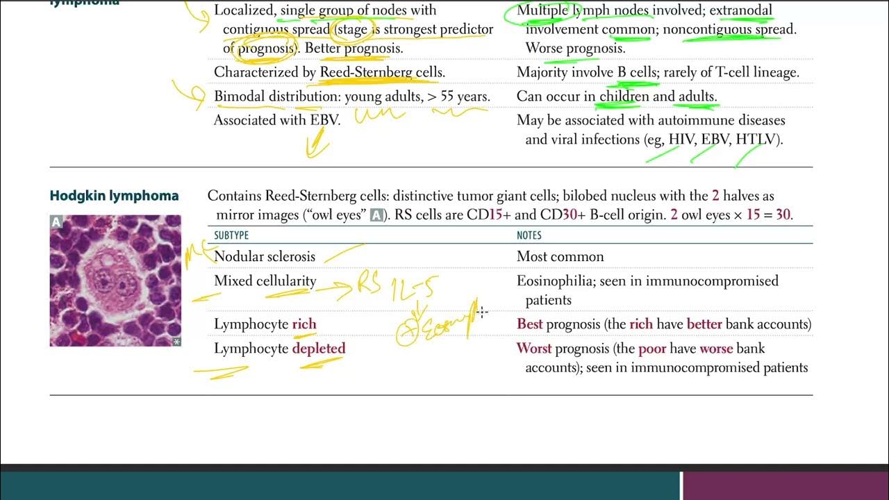 USMLE - 37 | Leukemia vs lymphoma | Hodgkin vs non‐Hodgkin lymphoma | (USMLE Step 1) - YouTube