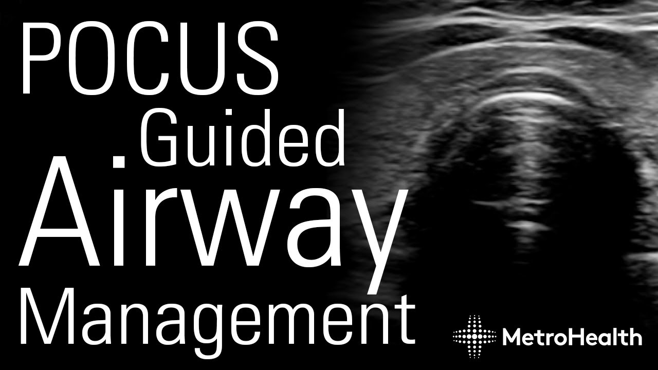 POCUS Guided Airway Management - YouTube