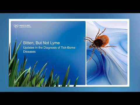 Bitten, But Not Lyme: A Diagnostic Dive