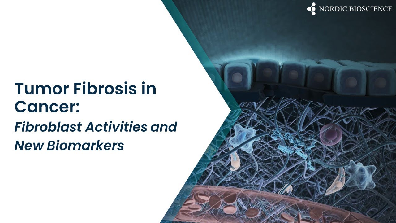 Webinar | Tumor Fibrosis in Cancer: Fibroblast Activities and New ...