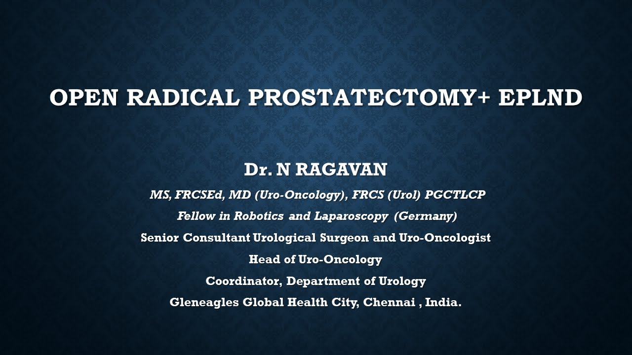 Open Radical Retro-pubic Prostatectomy Technique : Dr N Ragavan - YouTube