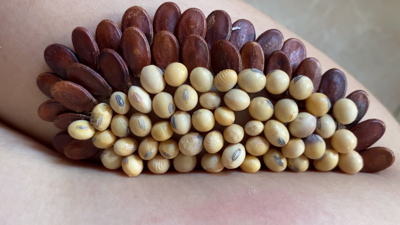 My fake ticks, Remove bean and watermelon seed tick from leg - YouTube