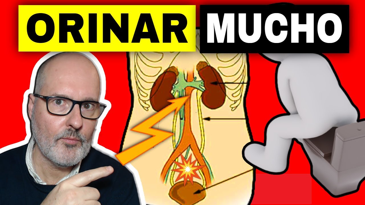 MICCIÓN EXCESIVA: ¿POR QUÉ ORINAS MUCHO o MUY FRECUENTE? (y SOLUCIONES ...