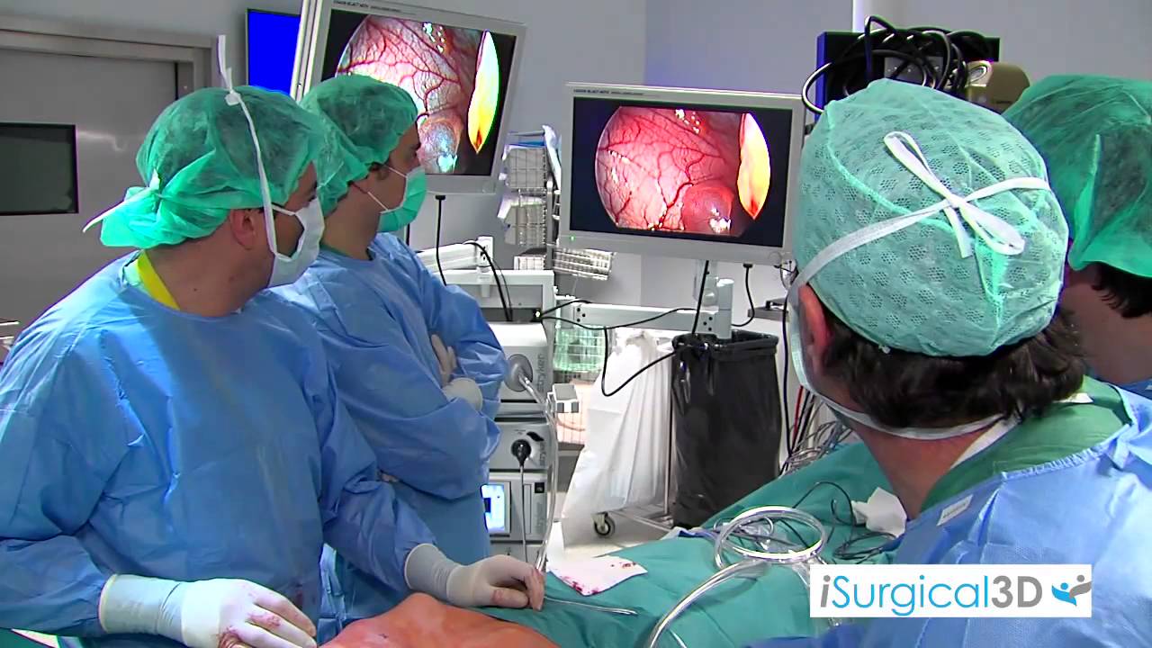 Pectus Excavatum Surgery Correction - YouTube