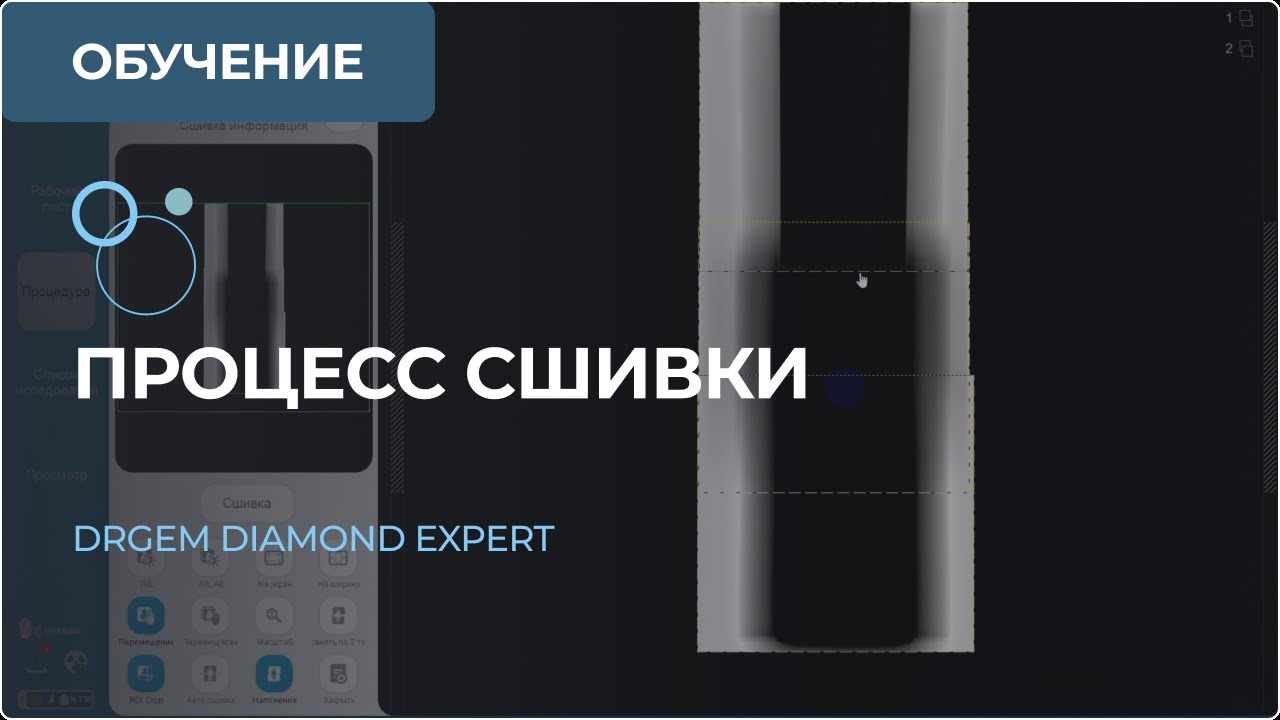 Сшивка изображений в RADMAX рентген-аппарата DRGEM DIAMOND. Часть 8 ...