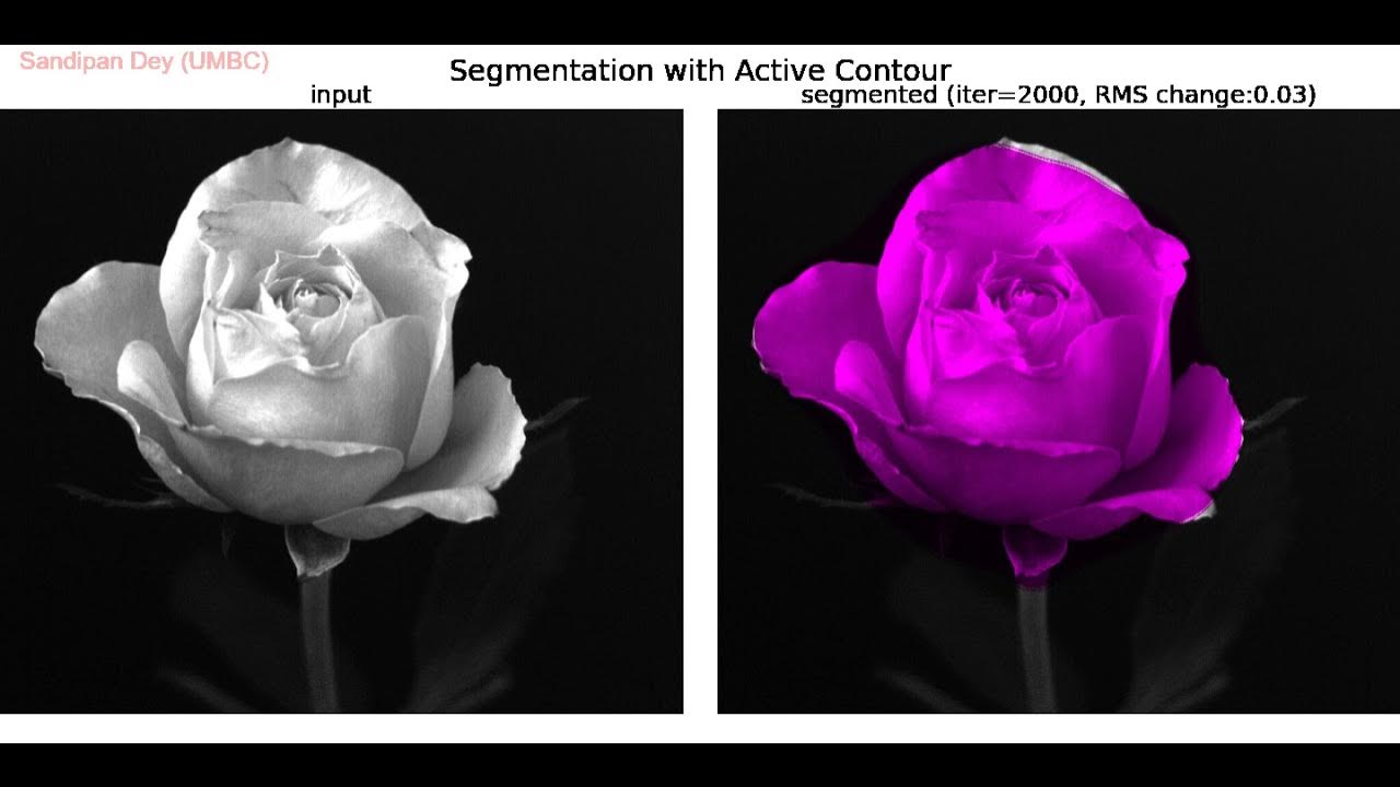 Image Segmentation | Active Contours | SimpleITK | Python - YouTube