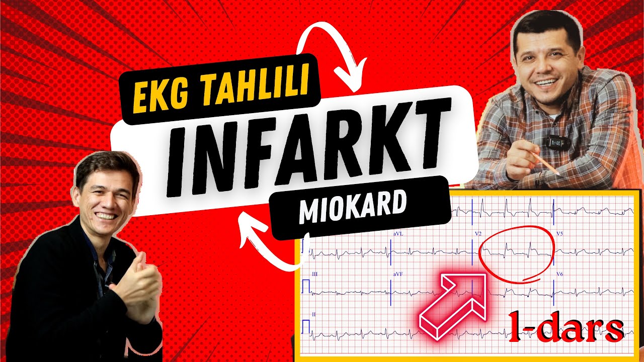 MIOKARD INFARKTI EKG TAHLILI - YouTube
