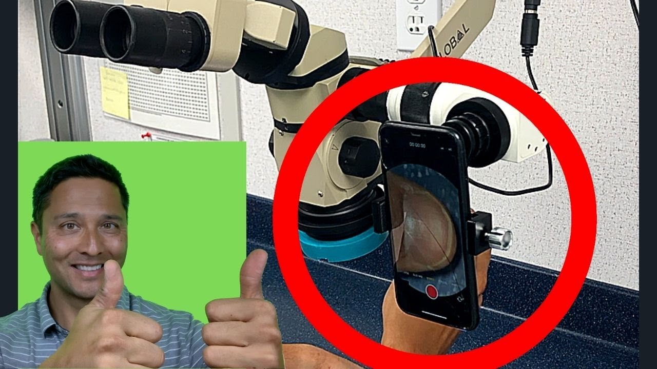 iPhone Adapter for Dental Microscope! {Finally....) - YouTube
