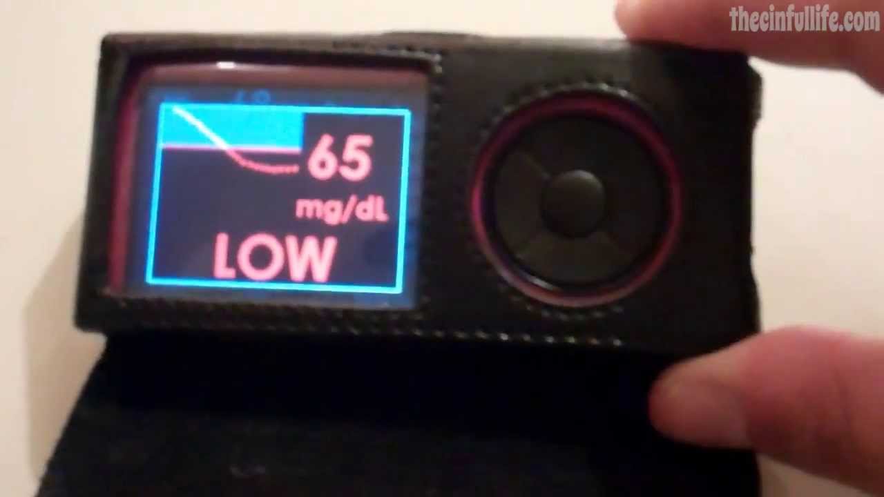 Dexcom G4 CGM Mini Review - YouTube