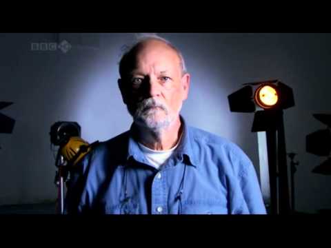 The Importance of UV Blocking in Intraocular lenses - YouTube