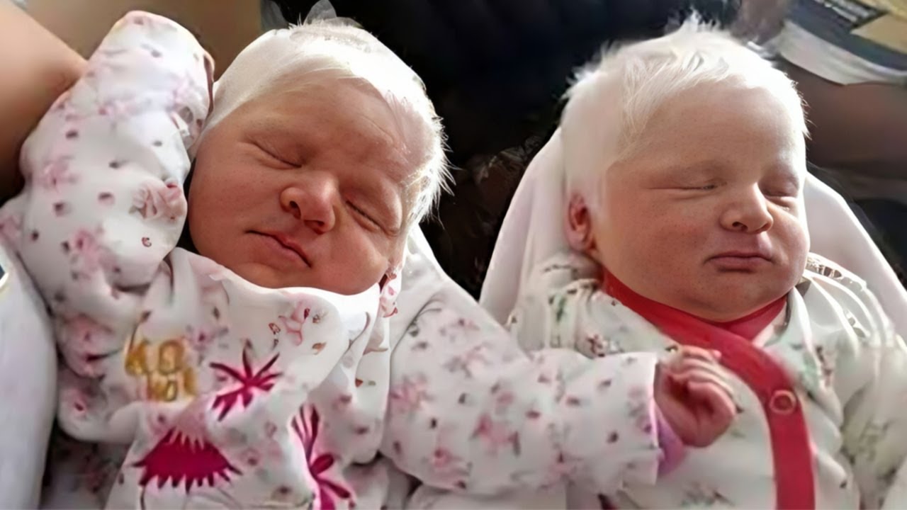 Born With White Hair