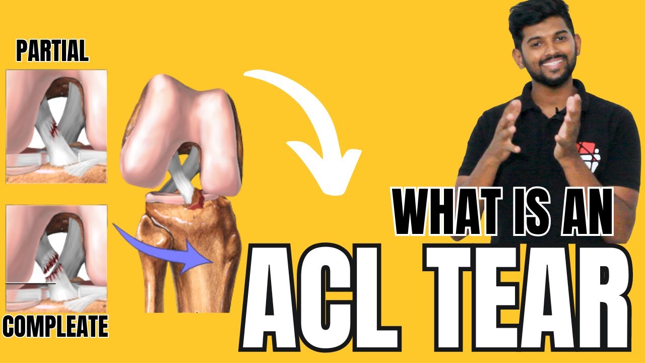 What Is An ACL And Why Are ACL Injuries Complicated? - YouTube