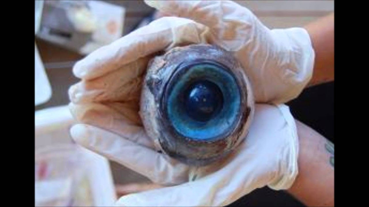 Giant eyeball found in Pompano Beach, Florida 10-12-12 - YouTube