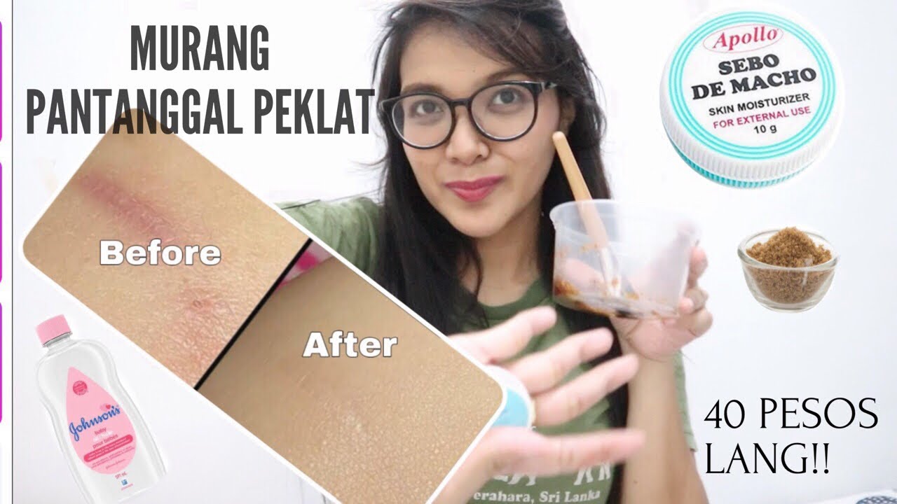 MURA AT EFFECTIVE PANTANGGAL PEKLAT (SCAR) + DIY SUGAR SCRUB - YouTube