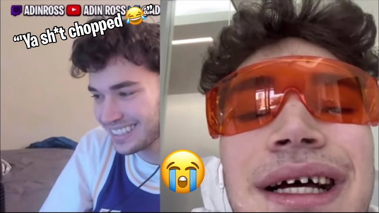 Adin’s real teeth 😨 🦷 (Veneer Process) - YouTube